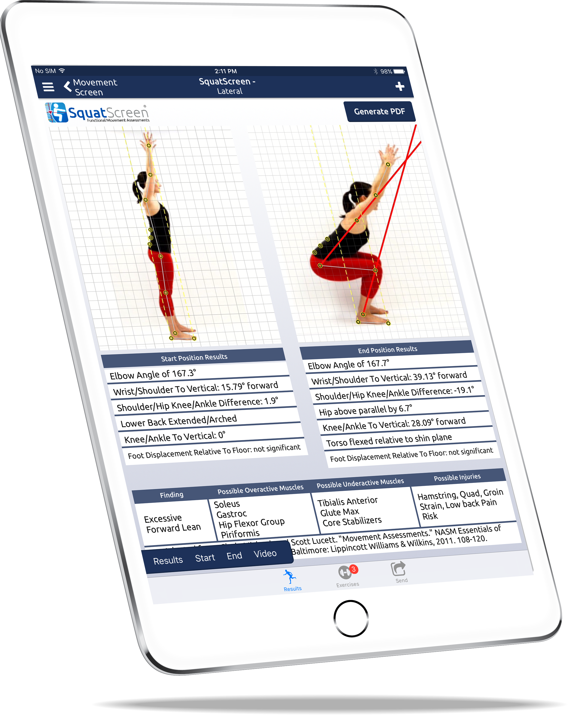SquatScreen - Functional Movement Assessment app | PostureCo, Inc ...
